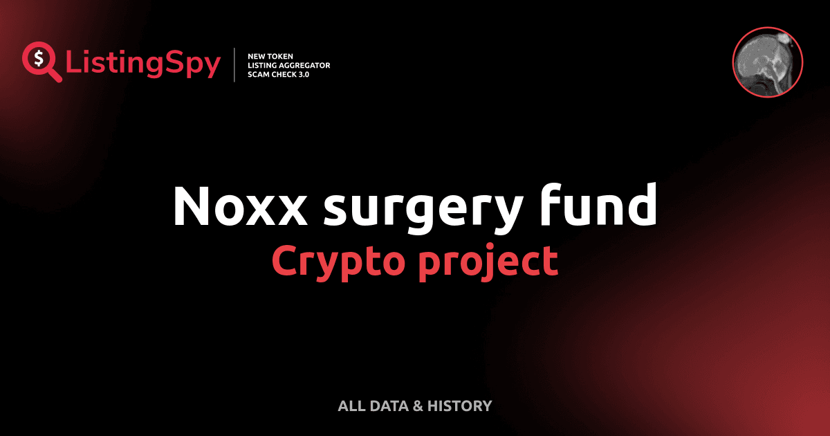 Noxx surgery fund crypto project: Noxx token listings, events, analysis ...